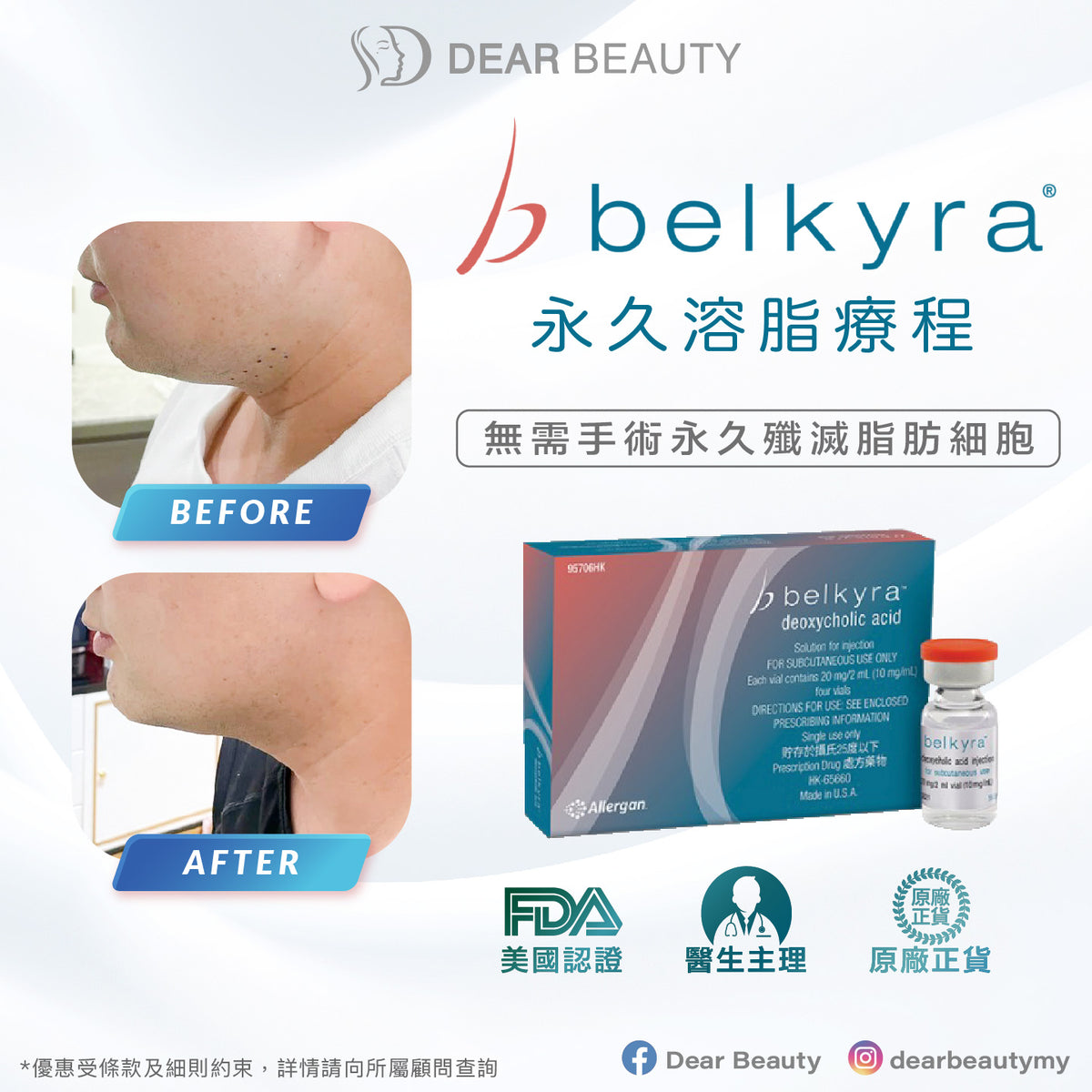 〖新客戶專享〗Belkyra 永久溶脂療程 2ml - 1次 – Dear Beauty